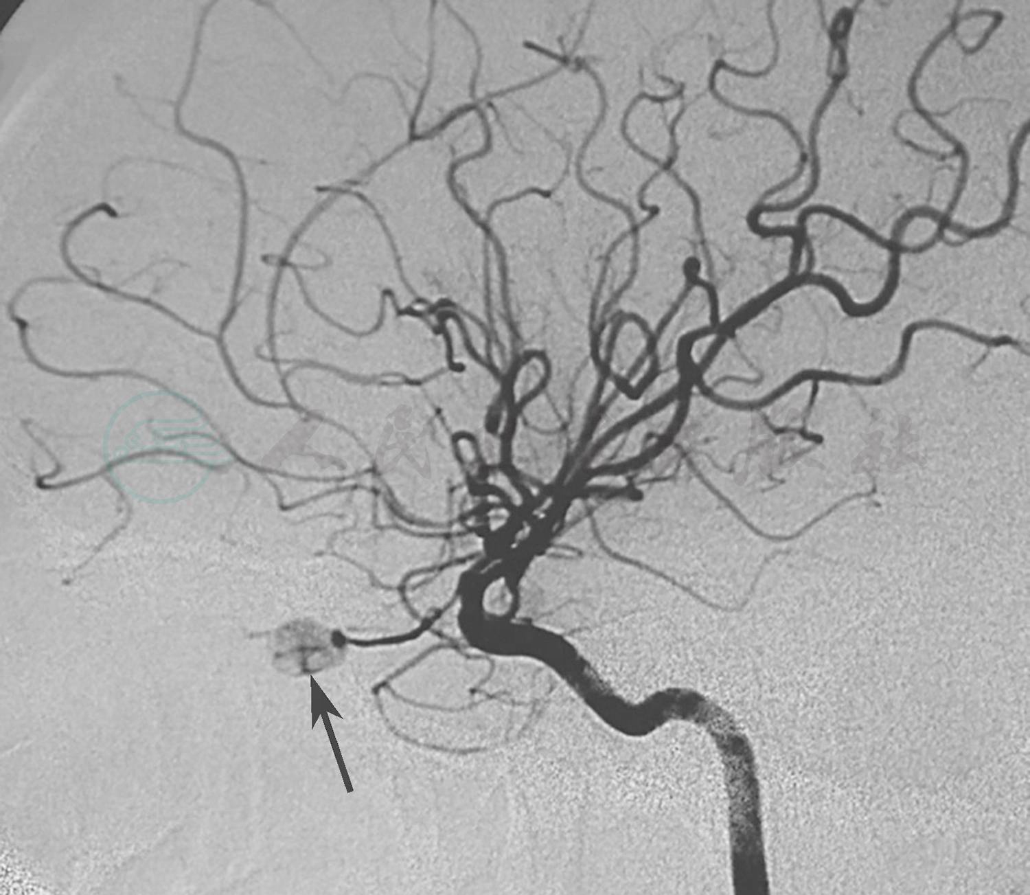 病例详情-病例-人卫临床助手-人民卫生出版社