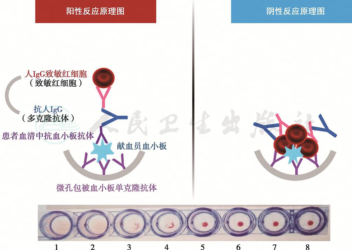 检验详情-人卫临床助手-人民卫生出版社