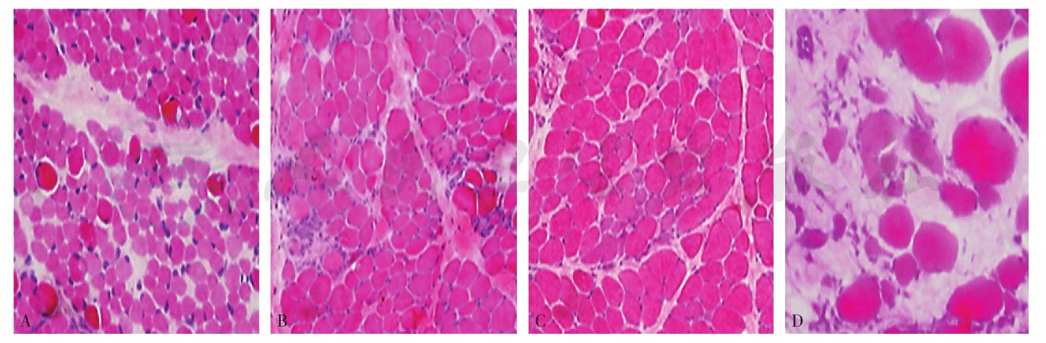 疾病详情-疾病-人卫临床助手-人民卫生出版社